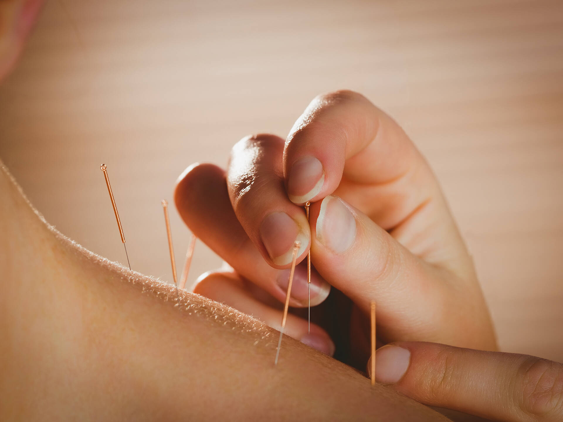 Find an acupuncturist in NYC at an alternative medicine studio