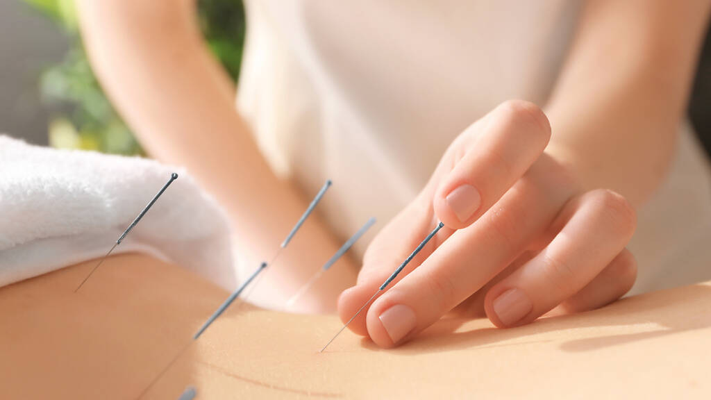 The 10 best acupuncture clinics in Melbourne