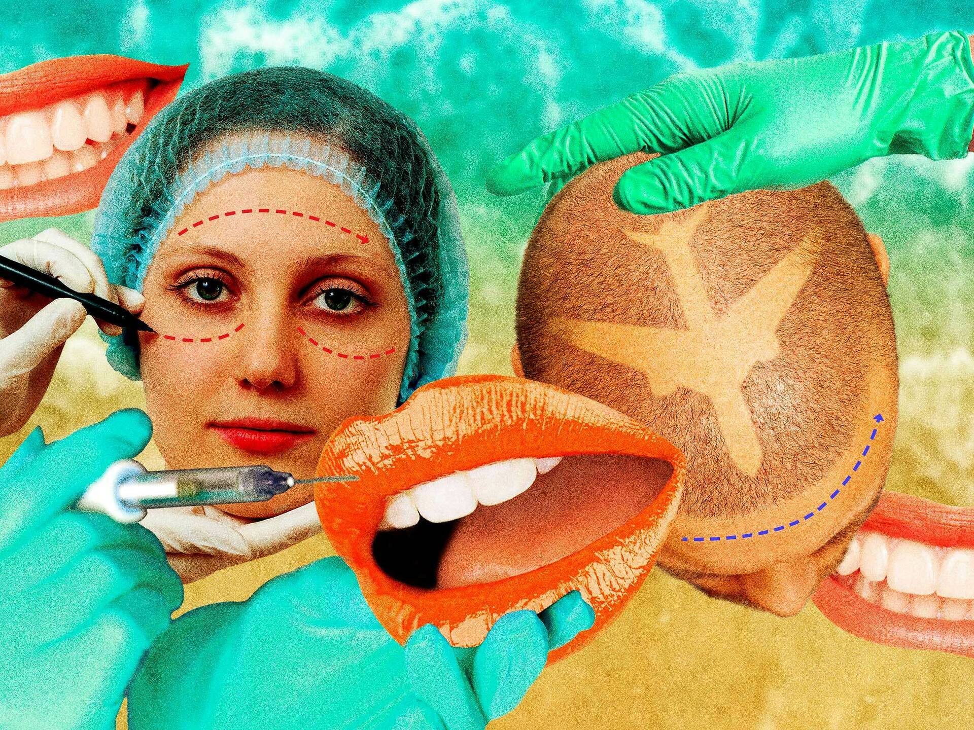 How Cosmetic Tourism is Changing European Travel